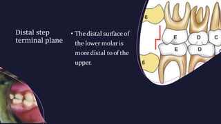 Molar relationship pedo | PPTX