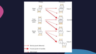 Molar relationship pedo | PPTX