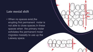 Molar relationship pedo | PPTX