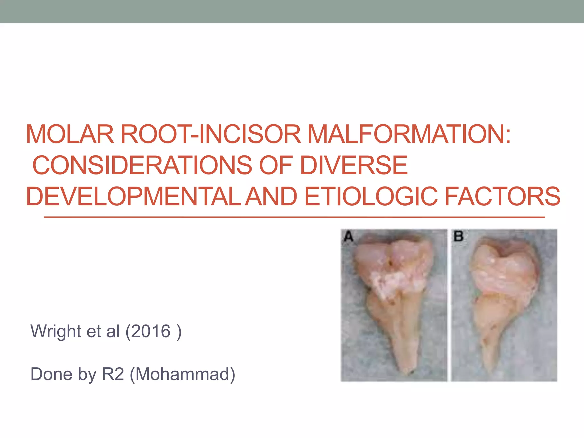 Molar Root-Incisor Malformation Causes and Histology | PPT