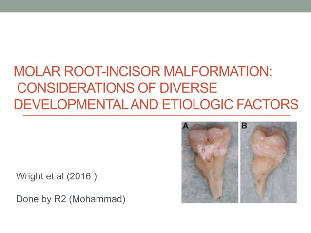 Molar Root Incisor Malformation | PPT