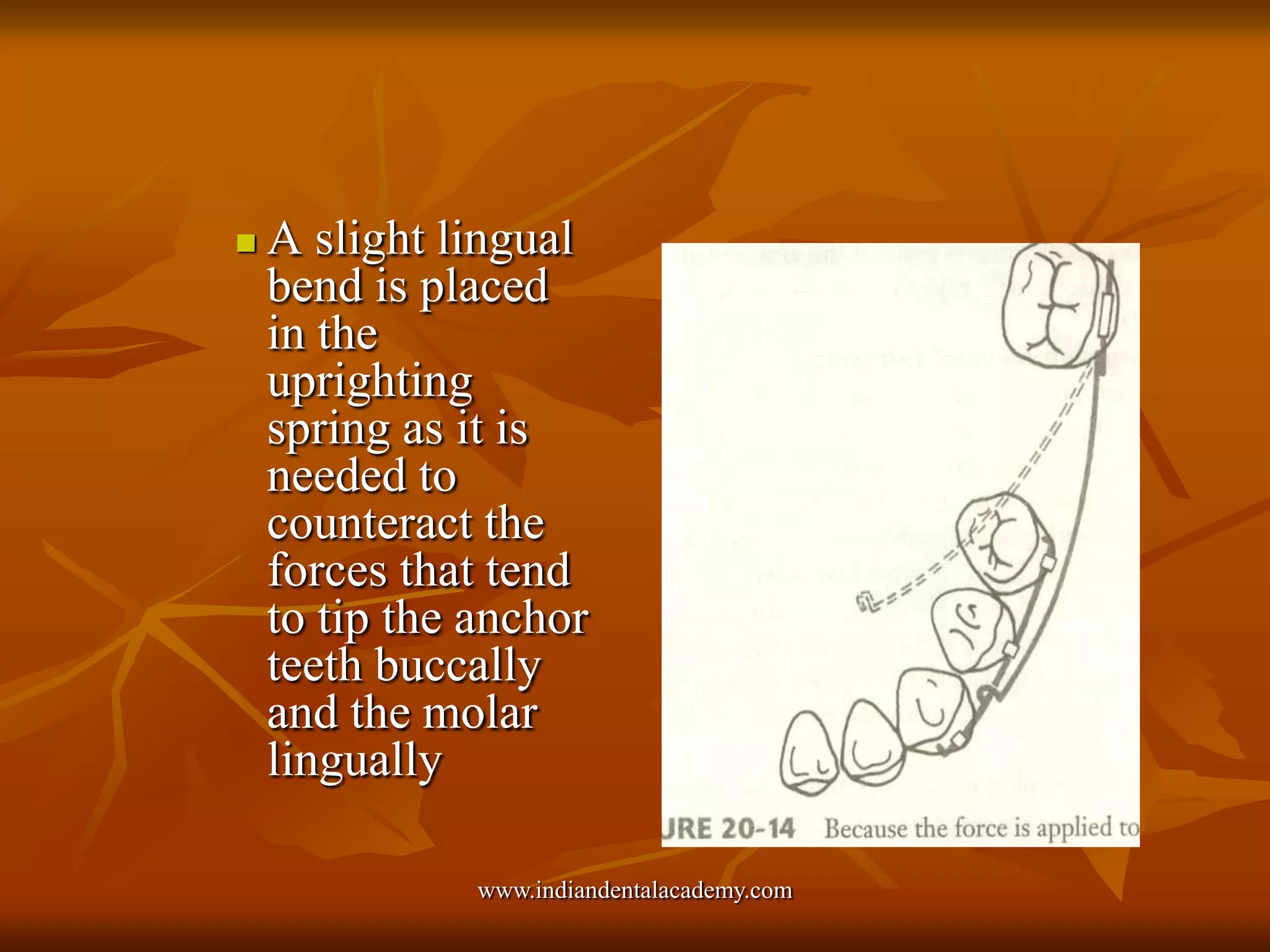 Molar uprighting | PPT