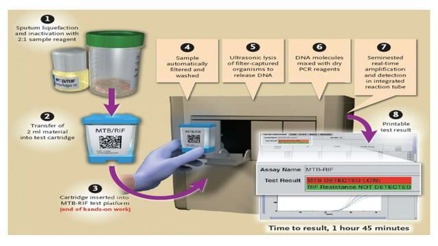 Molecular biology test for Tuberculosis | PPTX | Biological Sciences ...