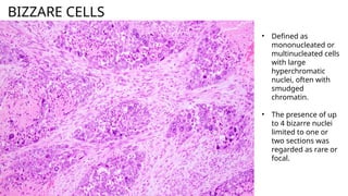 MOLECULAR CLASSIFICATION OF ENDOMETRIAL CARCINOMA.pptx