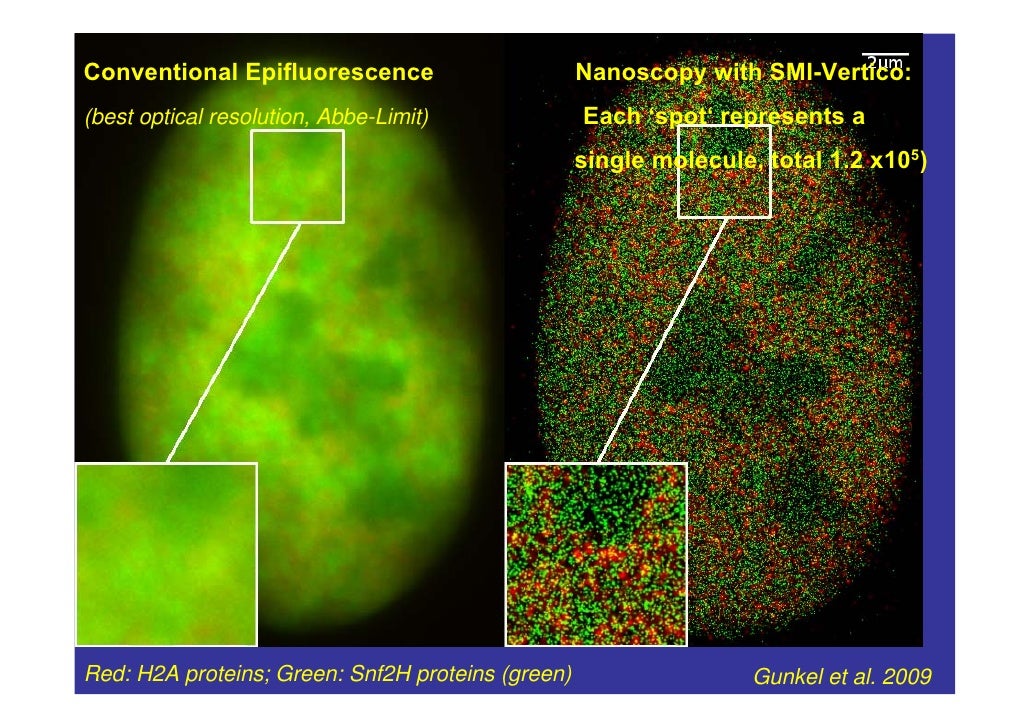 Super resolution microscopy & astronomy
