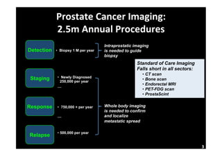 Molecular imaging and therapy in prostate cancer | PPT