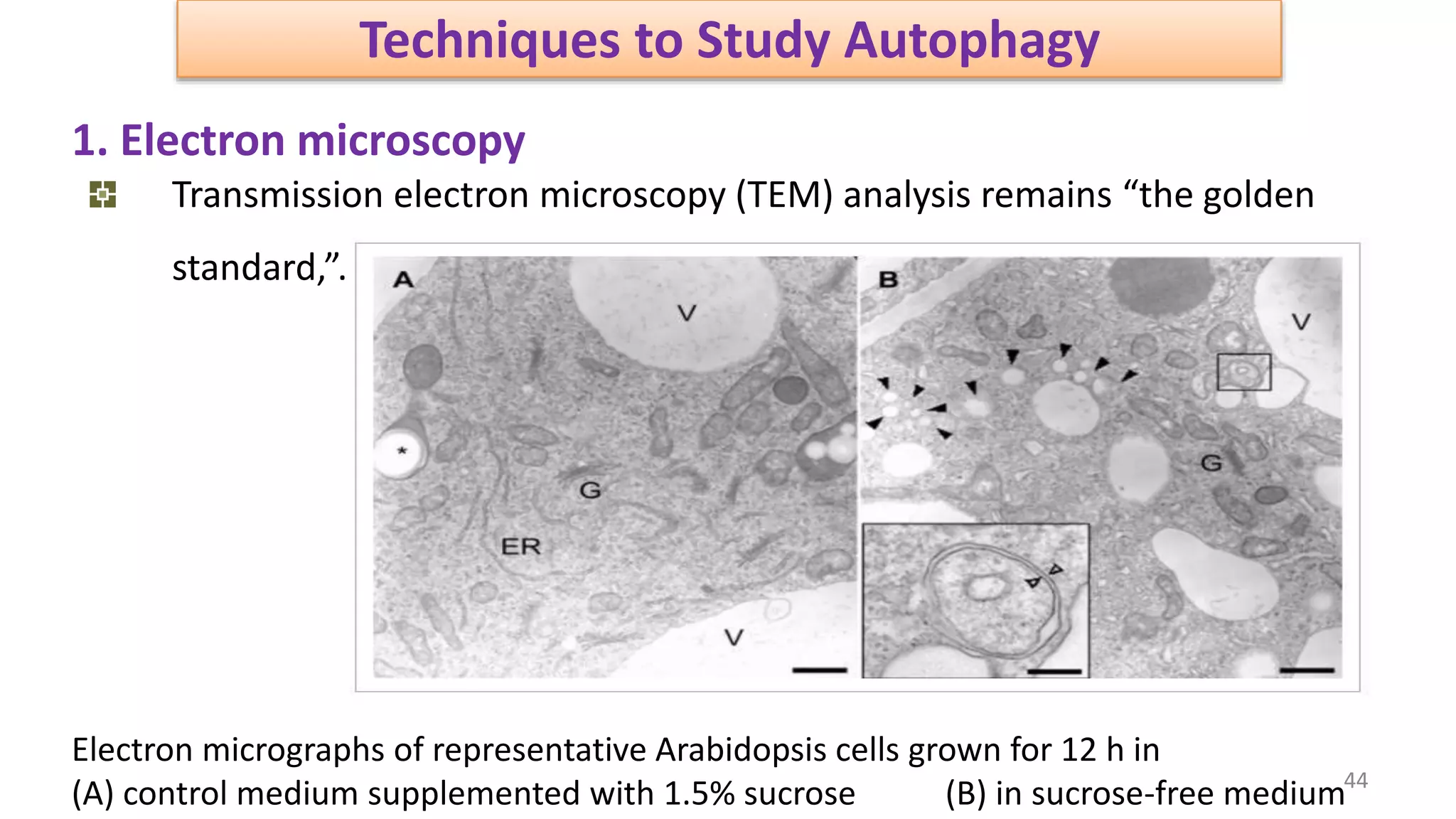 Autophagy | PPTX