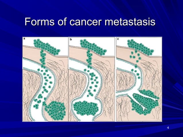 Molecular mechanism of cancer metastasis | PPT | Cancer | Diseases and ...