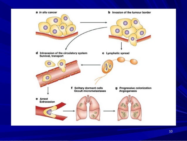 Molecular mechanism of cancer metastasis