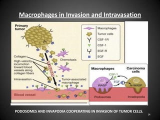 Molecular mechanism of tumor invasiveness | PPT