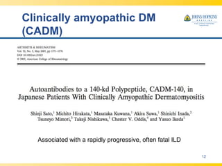 Molecular Mechanisms in ILD in Adult Connective Tissue Disease | PPT ...
