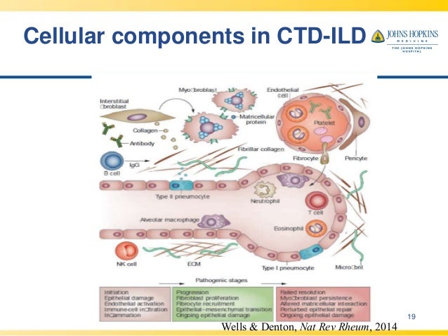 Molecular Mechanisms in ILD in Adult Connective Tissue Disease