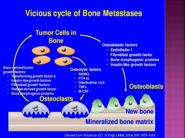 Molecular mechanisms of bone metastasis | PPTX