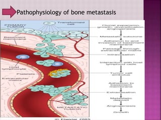 Molecular mechanisms of bone metastasis | PPTX