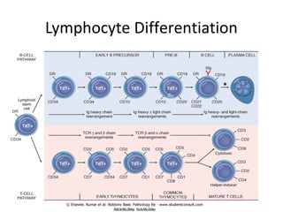 Molecular pathology of lymphoma by dr ramesh | PPT