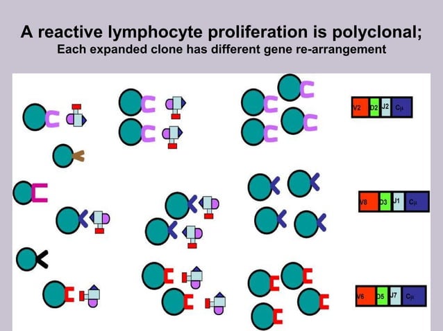Molecular pathology of lymphoma by dr ramesh | PPT