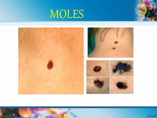 Moles | PPTX