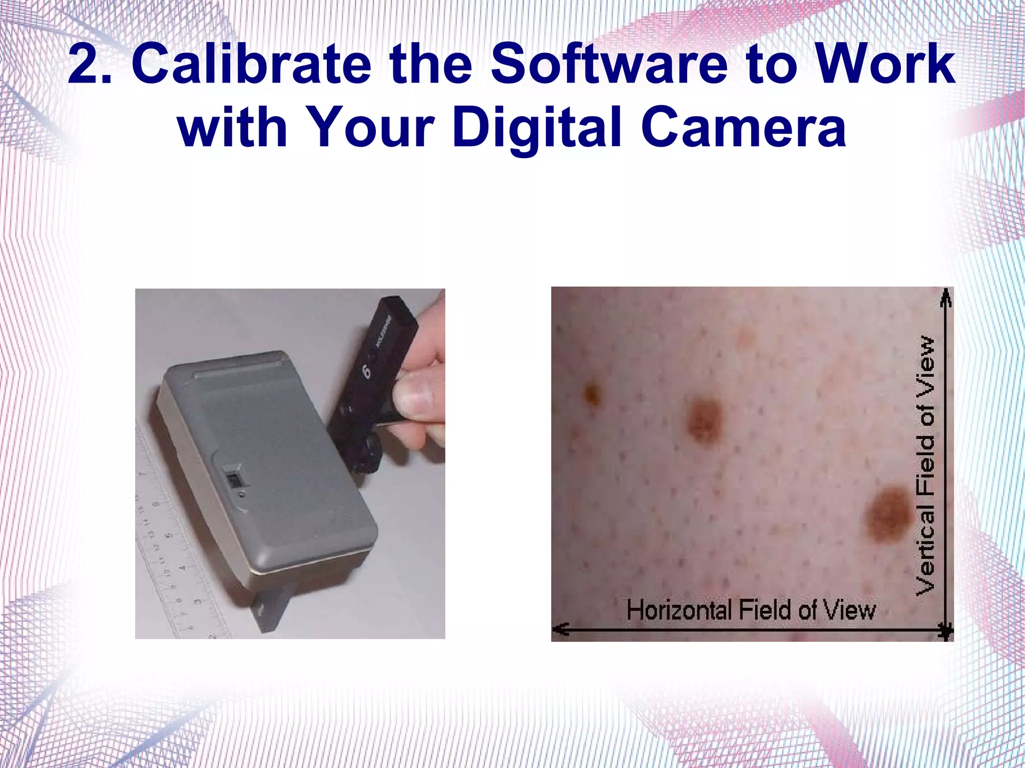 Mole Check with MoleSense | ODP