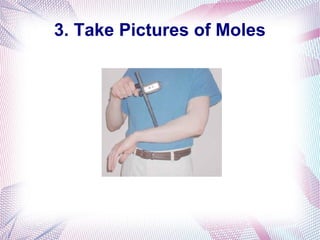 Mole Check with MoleSense | ODP