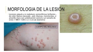MOLUSCO CONTAGIOSO | PPT