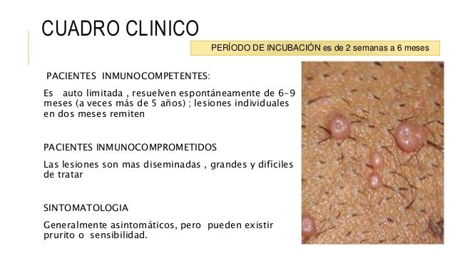 MOLUSCO CONTAGIOSO
