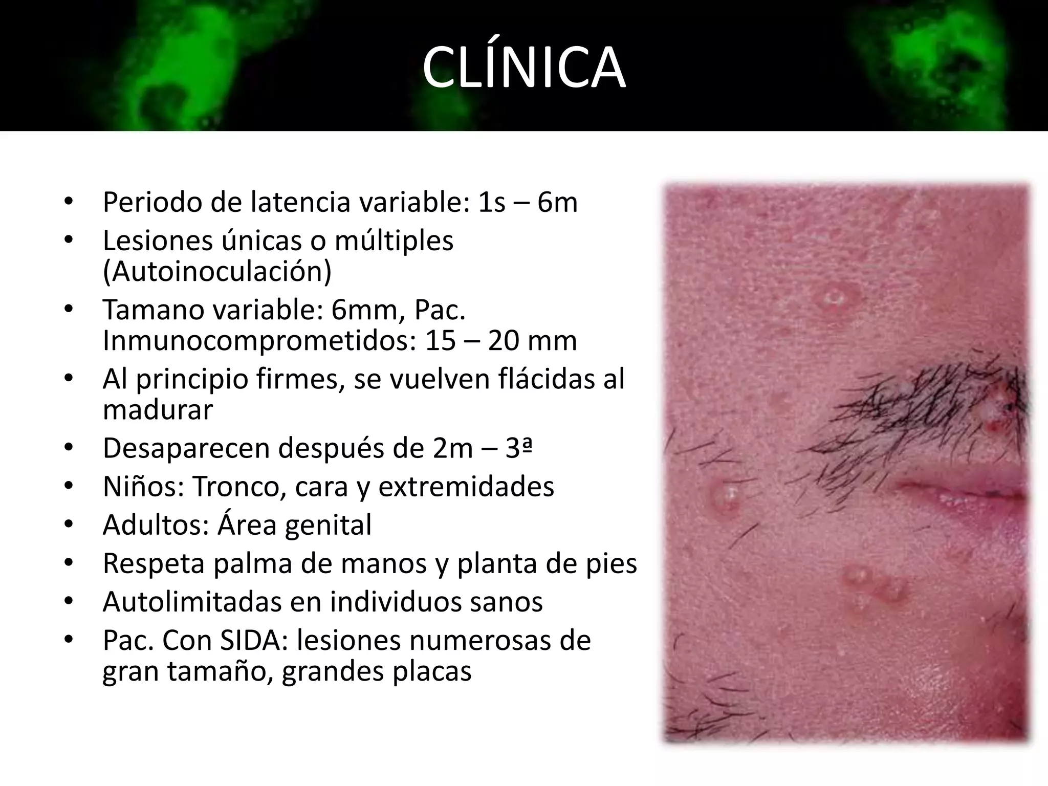 Molusco contagioso | PPTX