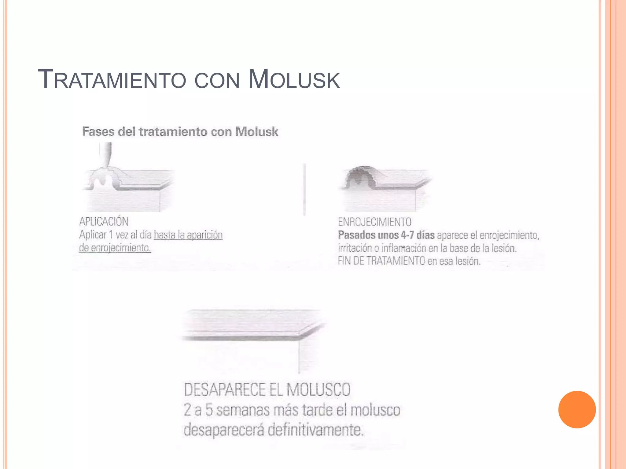 Molusco contagioso | PPTX