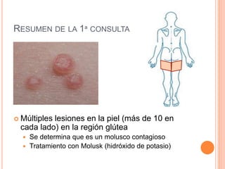 Molusco contagioso | PPTX