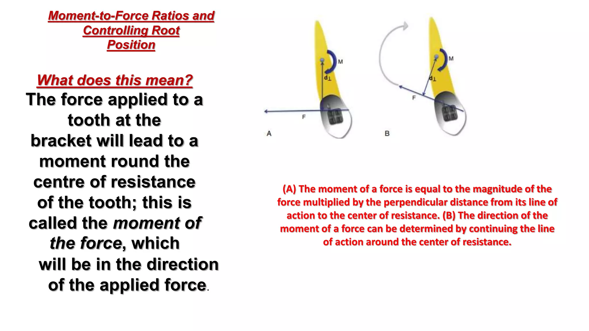 Moment-to-Force Ratios and Controlling RootNew Microsoft PowerPoint ...