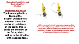 Moment-to-Force Ratios and Controlling RootNew Microsoft PowerPoint ...