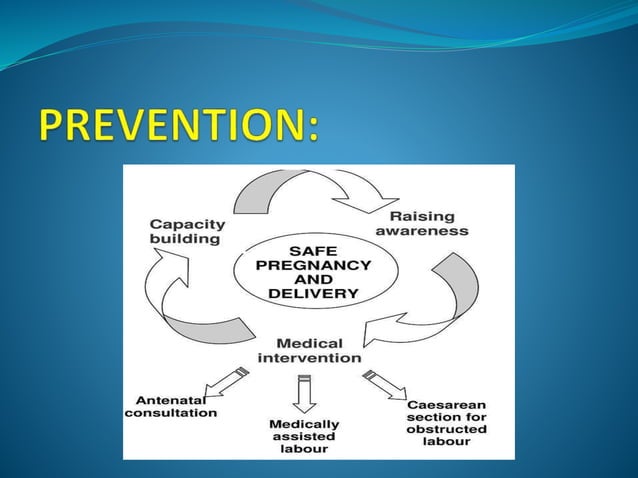 Obstructed Labour ppt | PPTX | Pregnancy | Reproductive Health