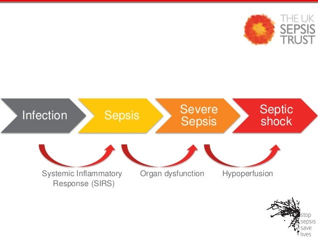 Sepsis - Process and Scale - Daniels