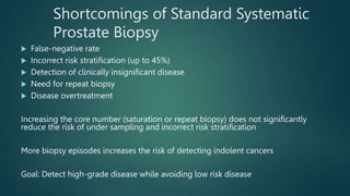 Mon 8-00 Prostate Cancer Screening in the Post-USPSTF Era_0.pptx