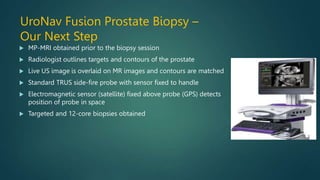 Mon 8-00 Prostate Cancer Screening in the Post-USPSTF Era_0.pptx