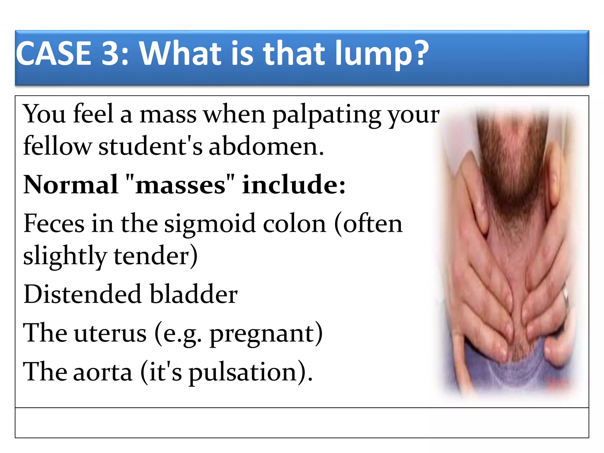Monday final abdominal examination final ppt | PPTX