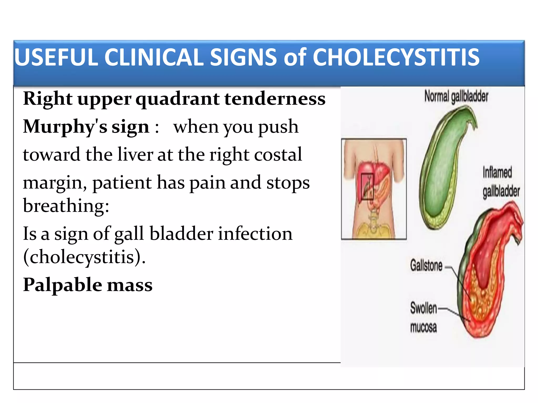 Monday final abdominal examination final ppt | PPTX
