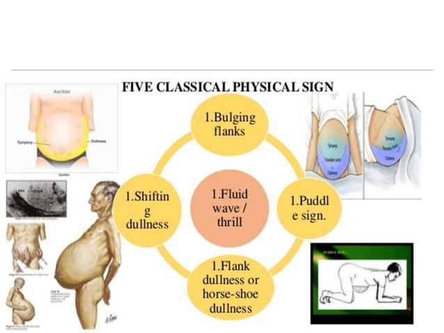 Monday final abdominal examination final ppt | PPT