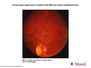 Haematology and Acute Oncology Part Two | PPT