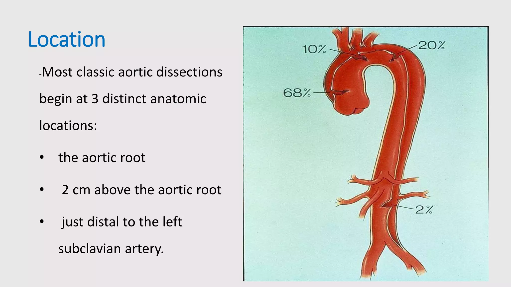 Aortic Dissection | PPT