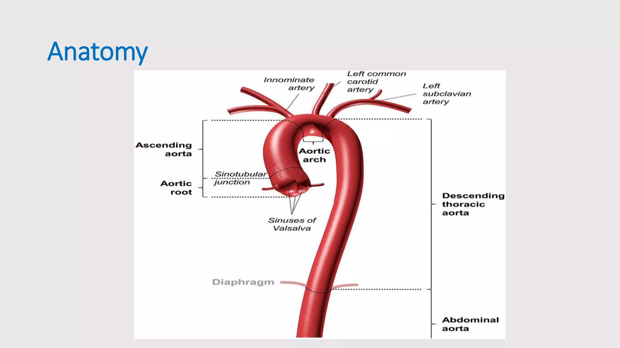 Aortic Dissection | PPT