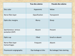 Approach to a case of disc oedema | PPT