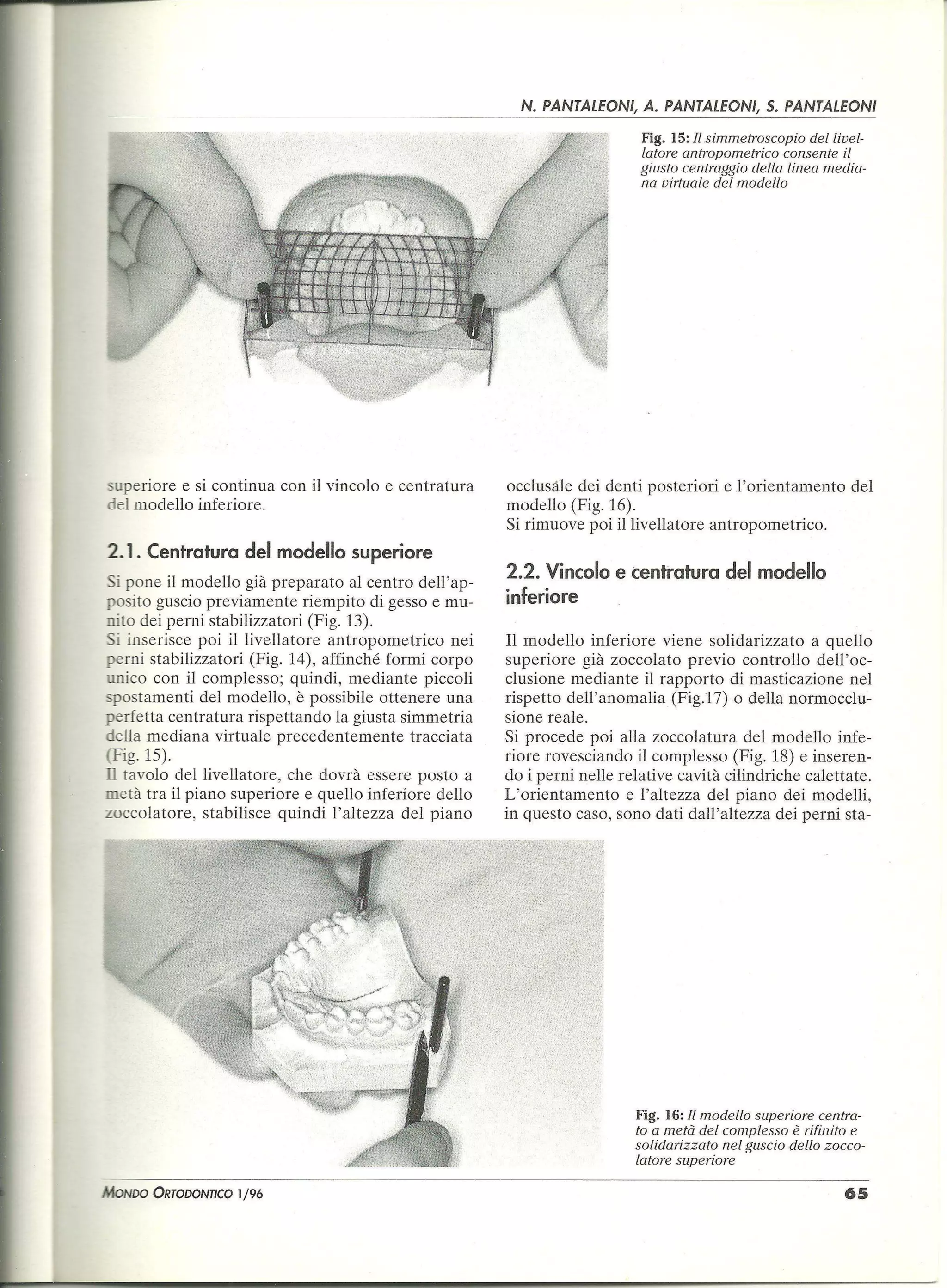 Mondo ortodontico - Estratto : Modello da museo o da studio ...