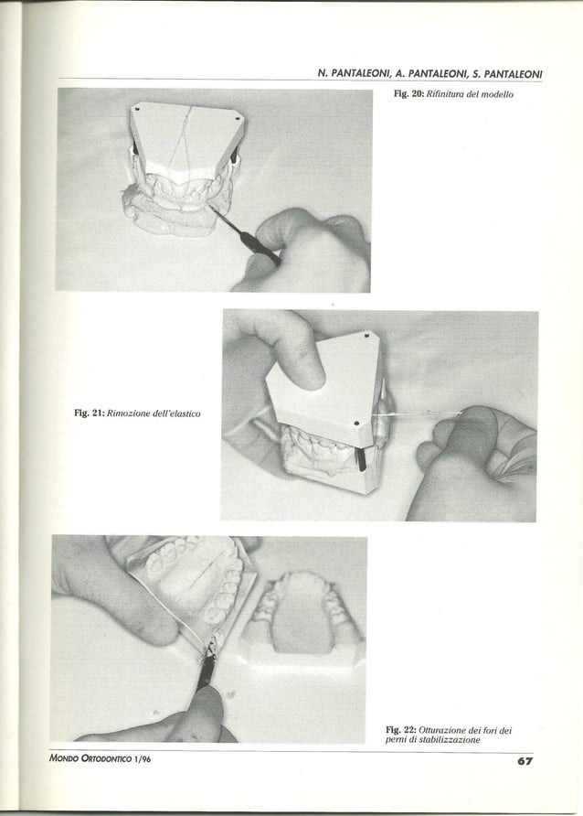 Mondo ortodontico - Estratto : Modello da museo o da studio ...