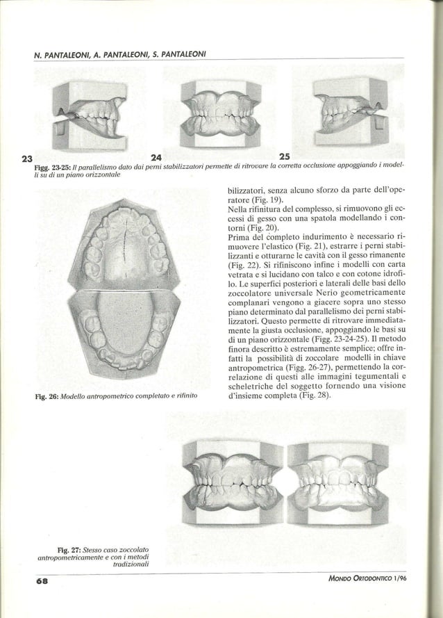 Mondo ortodontico - Estratto : Modello da museo o da studio ...