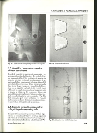 Mondo ortodontico - Estratto : Modello da museo o da studio ...