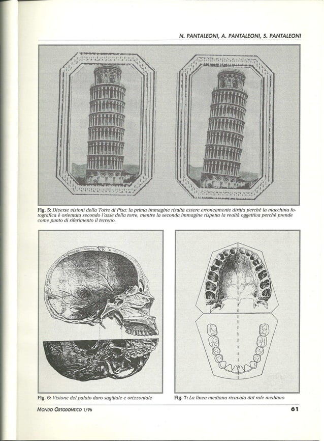 Mondo ortodontico - Estratto : Modello da museo o da studio ...