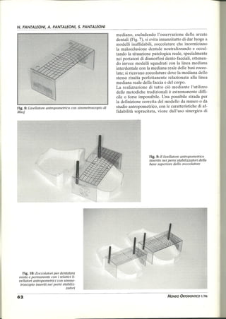 Mondo ortodontico - Estratto : Modello da museo o da studio ...