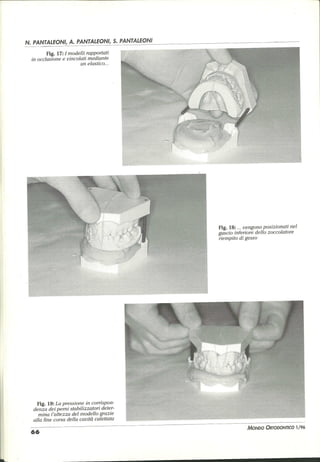 Mondo ortodontico - Estratto : Modello da museo o da studio ...