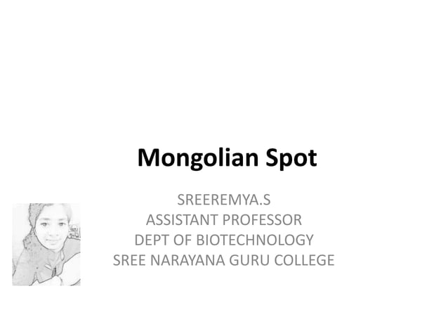 Mongolian spot | PPTX | Skin and Dermatology | Diseases and Conditions