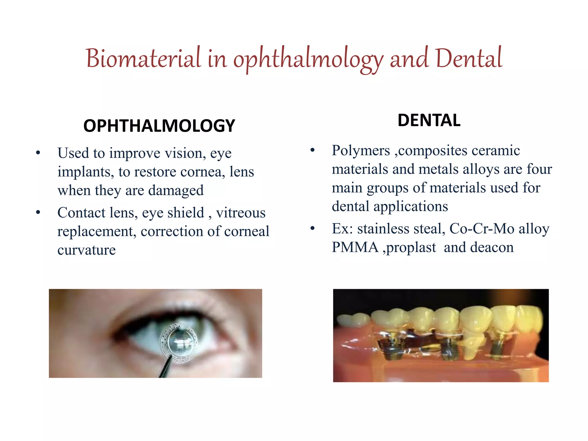 classification of biomaterials by vishnumenon.m | PPTX